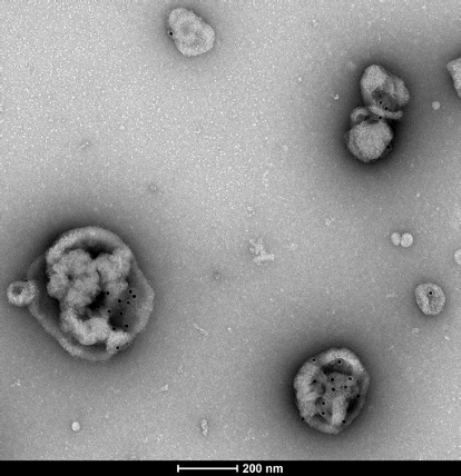 Plasmodium Project-2 - BNITM